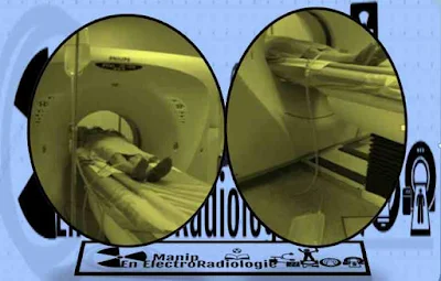 COLOSCANNER MEILLEUR EXPLICATION