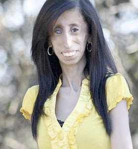 strano66: 7 Manusia Paling Kurus di Dunia dan Menyeramkan