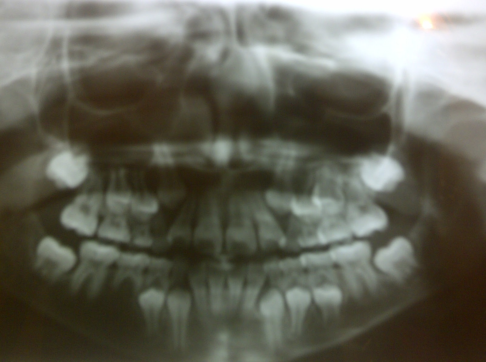 Casos Clinicos Odontologicos: ORTOPEDIA DENTAL
