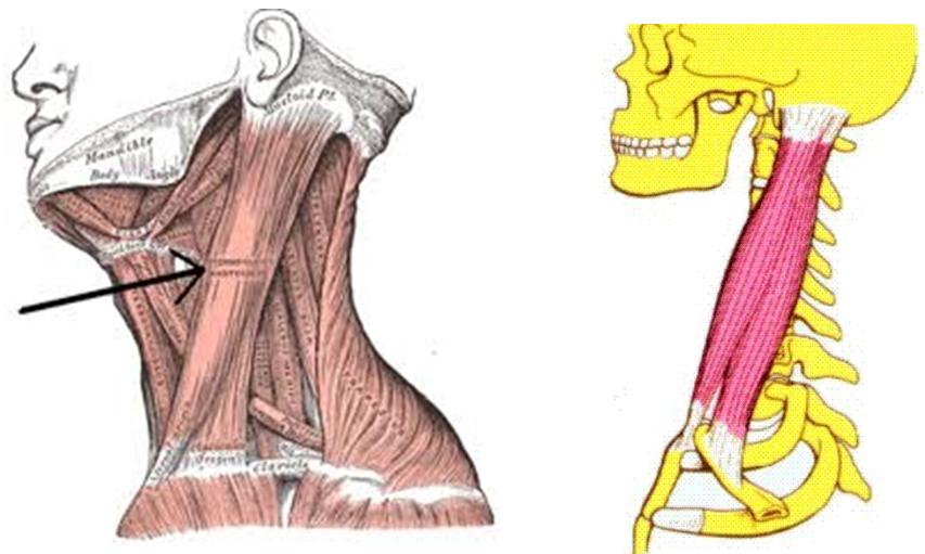 Fisioblogando: Acordou com Torcicolo?