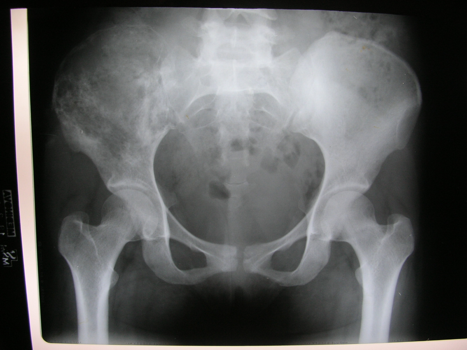 X-rays and Slides: picture92
