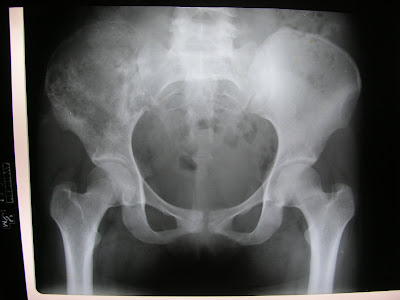 X-rays and Slides: picture92