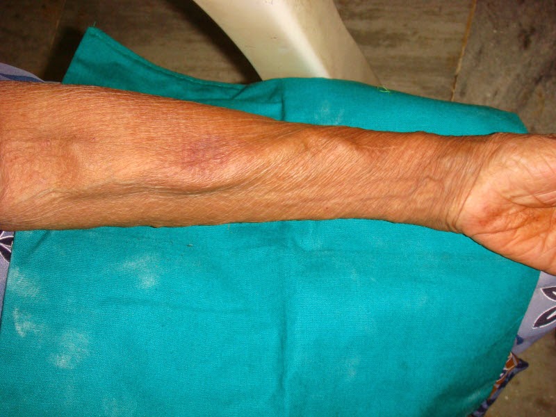 Spesialis Bedah Vaskular dan Endovaskular: Pertanyaan seputar akses ...