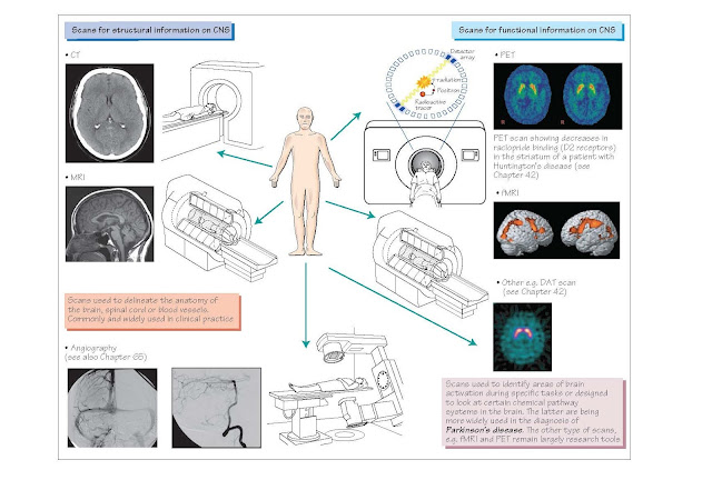 Imaging Of The Central Nervous System - pediagenosis