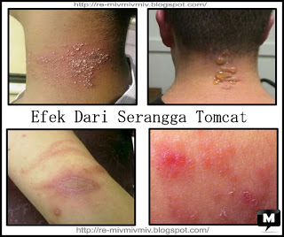 ABS project Group: Asal-Usul Serangga Tomcat dan Cara Mengatasinya