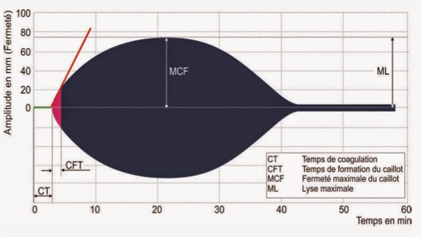 Manuali di Medicina Intensiva: Tromboelastogramma - ROTEM (Capitolo 2 ...