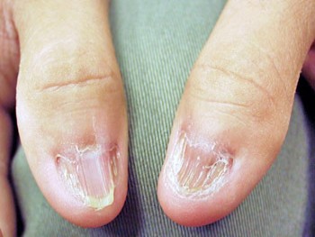 The Naily Guide To Flaws And Fungus: April 2016