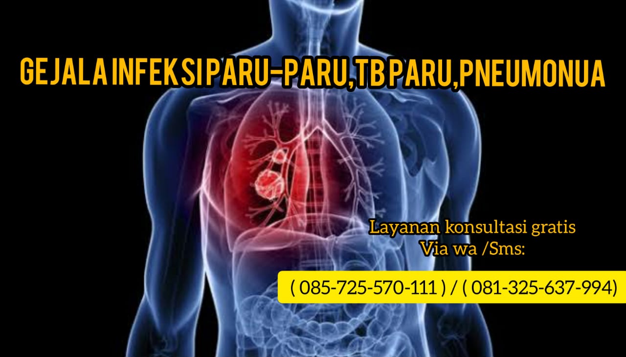 infeksi paru-paru karena perokok aktif dan perokok pasif