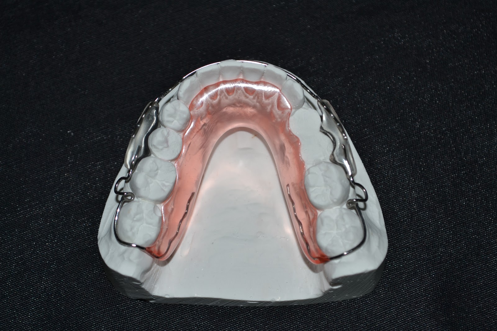 Laboratorio Ortodontico MRdental: PLACCA DI CONTENZIONE CON ARCO CONTINUO