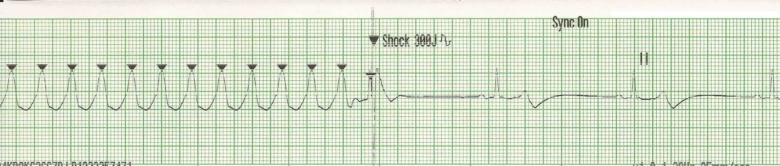Electrical Interventions