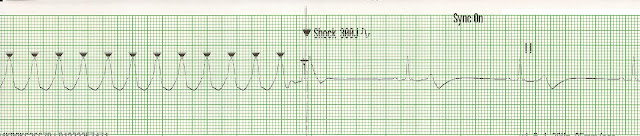 Electrical Interventions