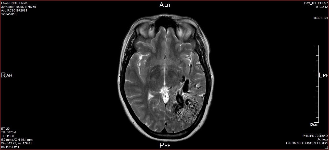 What’s wrong with you now…..spaghetti brain?