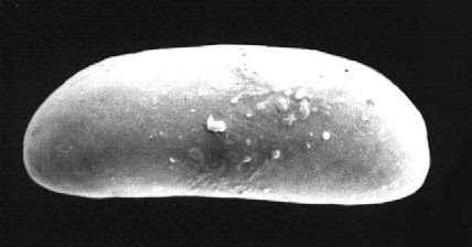 Variety of Life: Cytheroidea