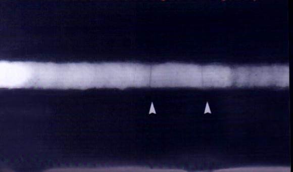 WELDSTRONG ELECTRODES : HOW TO IDENTIFY WELDING DEFECTS IN RADOAGRAPHY ...