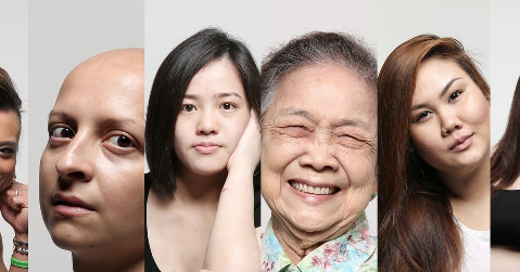 26.How do the skin age? Intrinsic aging and extrinsic aging