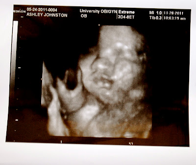 The Johnston's: {36 weeks & baby update}