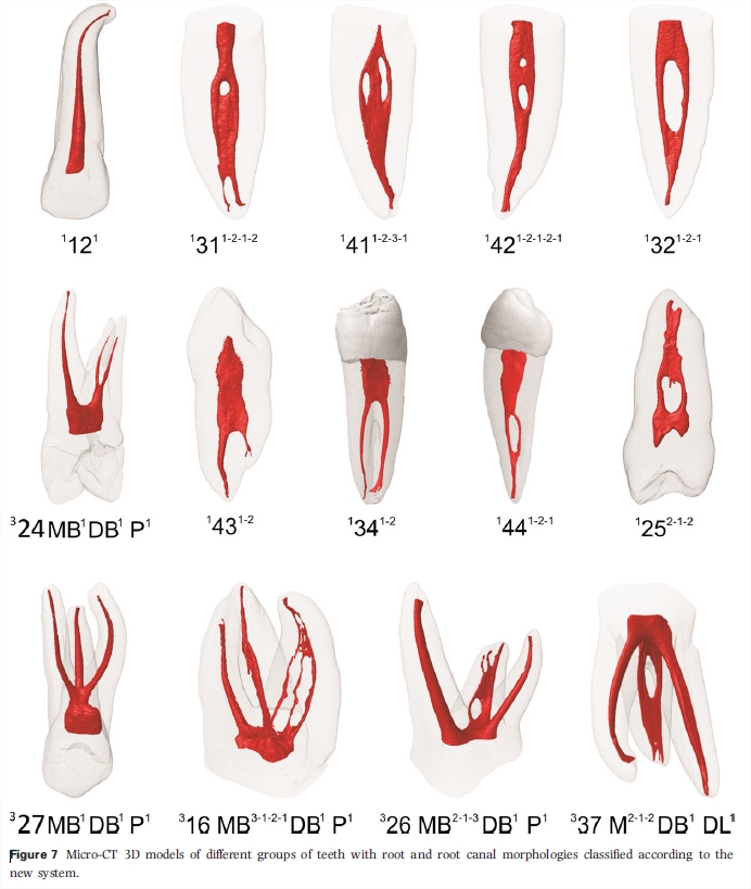 The Root Canal Anatomy Project: New Publication: International ...