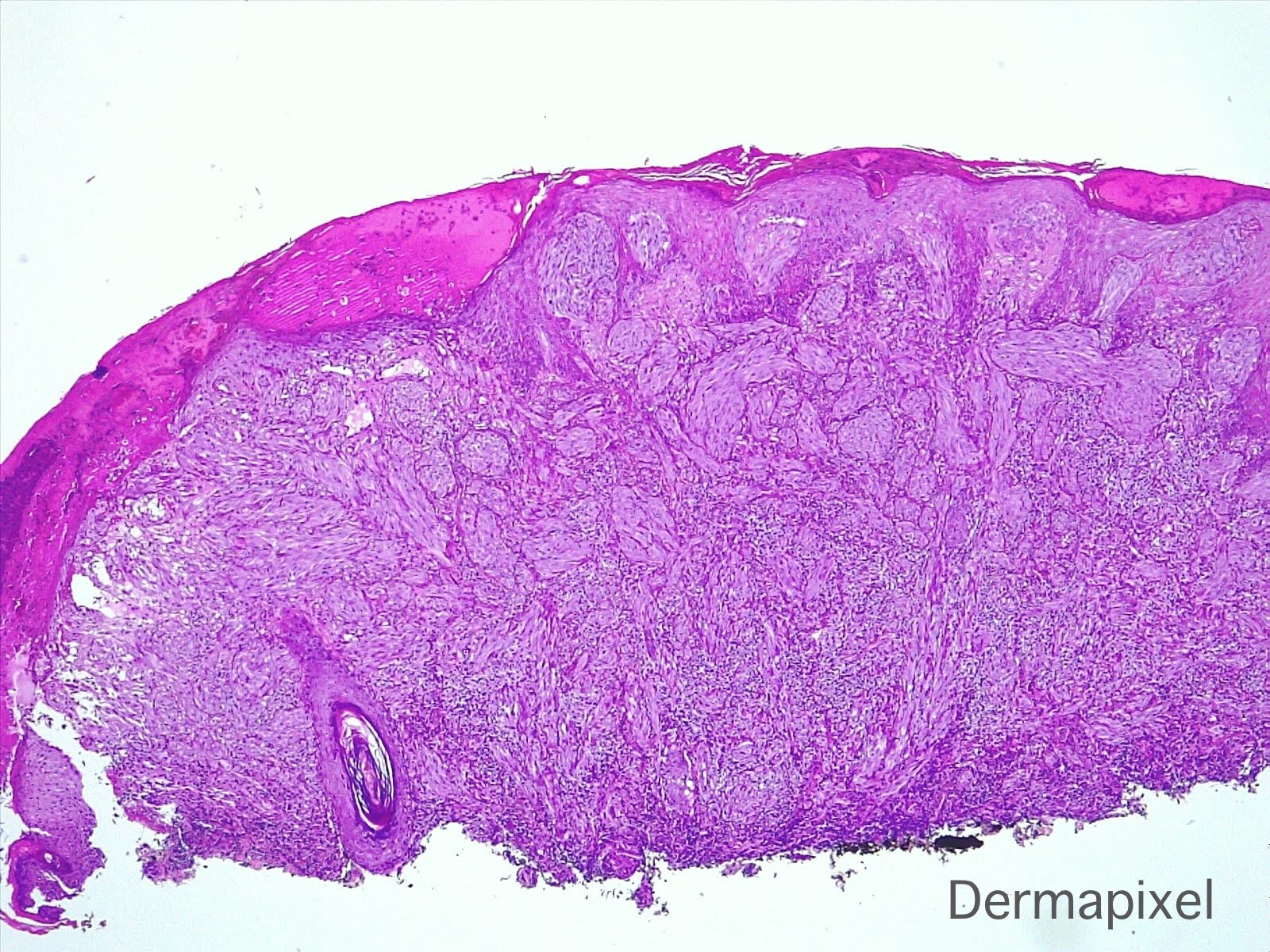 Dermapixel: enero 2021