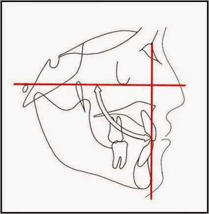 Tareas de Odontología : ANALISIS DE DOWNS
