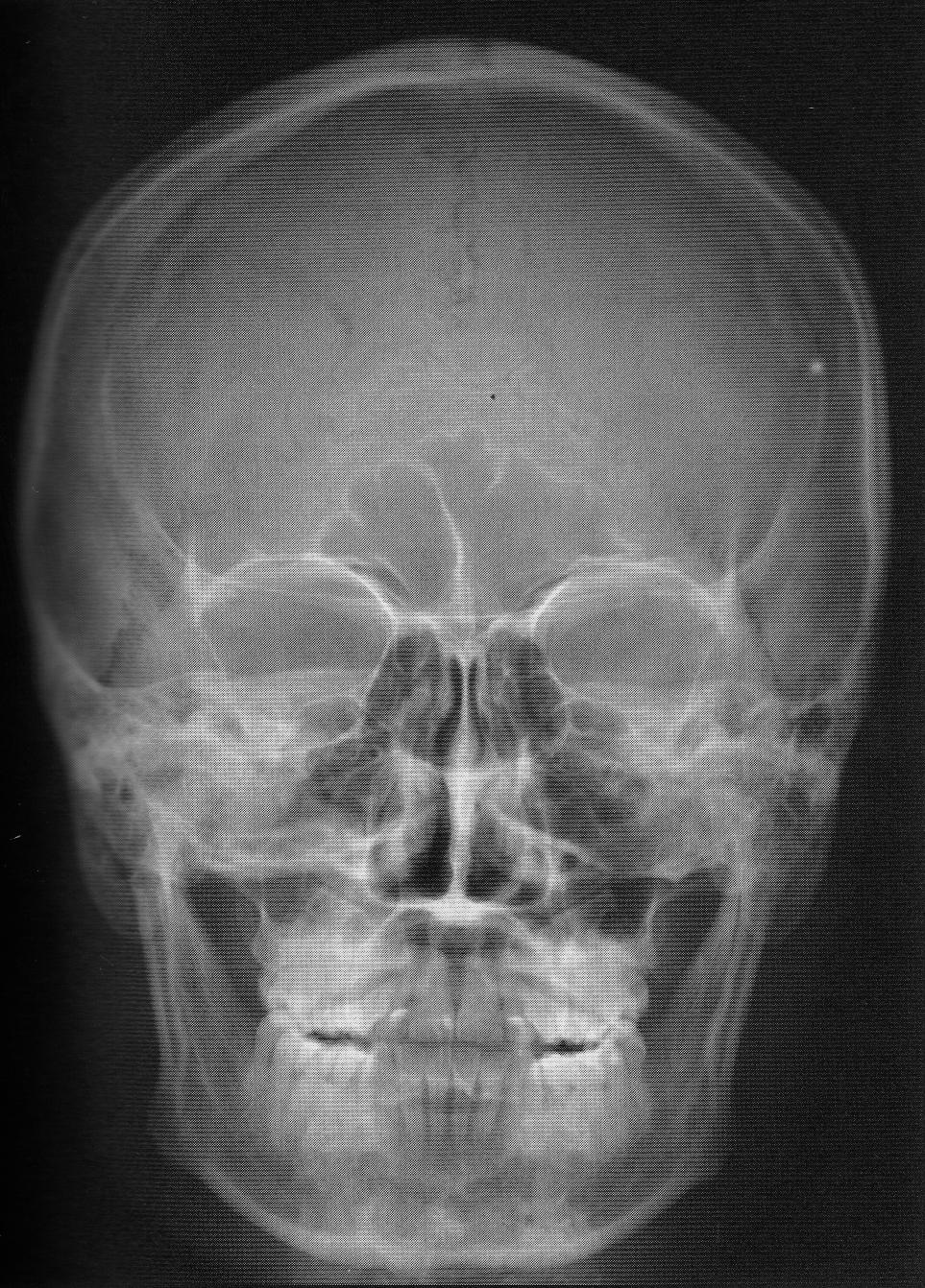 RADIOLOGIA: POSICIONAMENTO DA FACE
