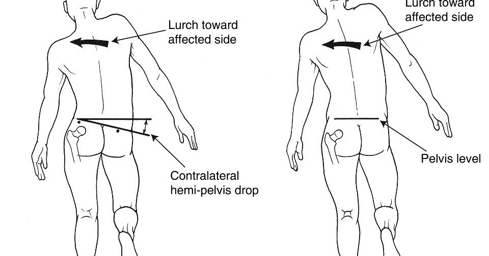 GABINETE LUISI MOTTA: Marcha de "TRENDELENBURG" También es llamada ...