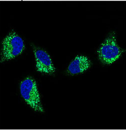 Labeling and Visualization of Lysosome using Lysotracker