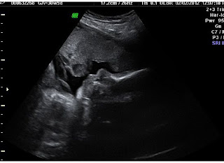 The Whaleys: 31 Week Ultrasound