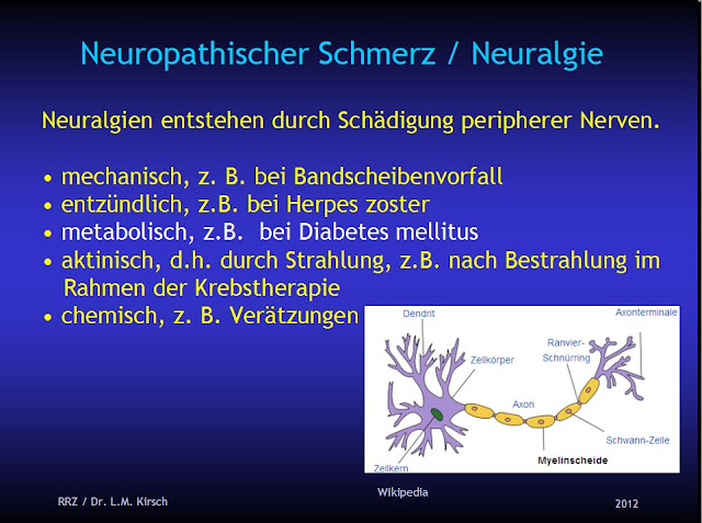 Rheumatologe: Verschiedene Schmerzarten in der Rheumatologie