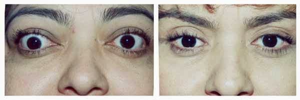 Eye Care Center: October 2014