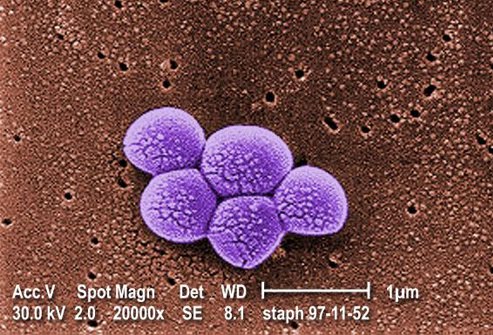 Healthy Life: MRSA (Methicillin-Resistant Staphylococcus Aureus)