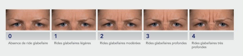 TRAITER LA RIDE DU LION ( OU DE LA GLABELLE )