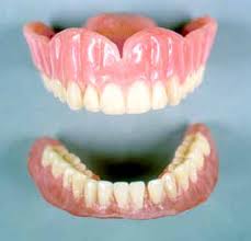 Todo sobre Prótesis Completa Dental (dentadura postiza)