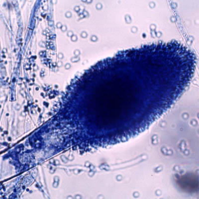 Sustainable Mycology: Aspergillus clavatus