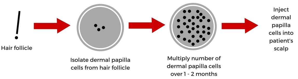 hair solutions: Hair Cloning & Multiplication