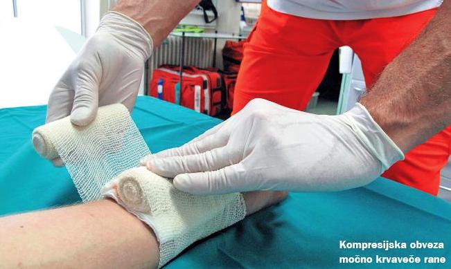 kUTEZEVO-pp: KRVAVITEV NA ZAPESTJU