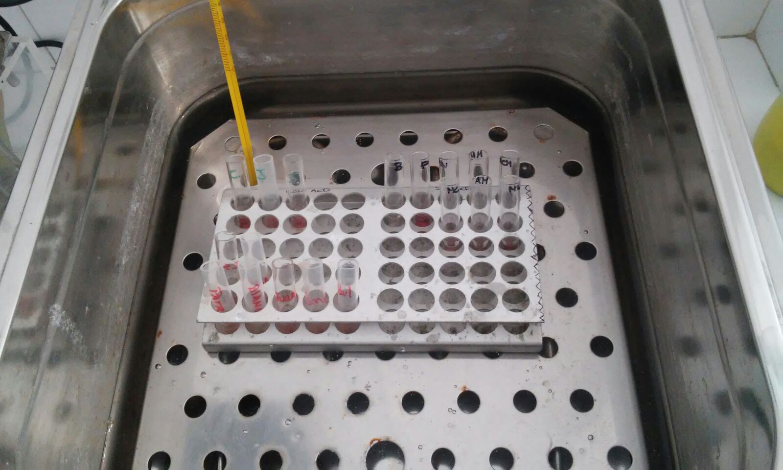 Prácticas Bioquímica: octubre 2015