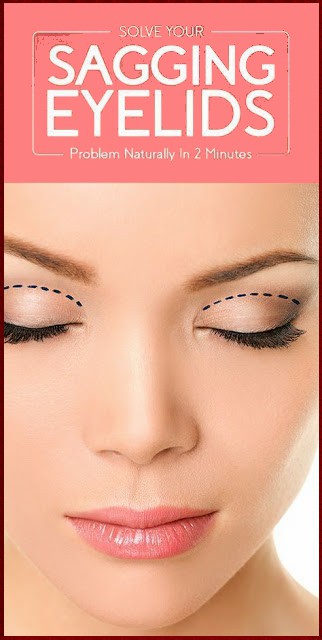 Want To Get Ride Of Sagging Eyelids Problem In Just 2 Minutes