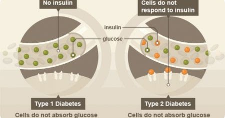 Reverse Type 2 Diabetes Naturally