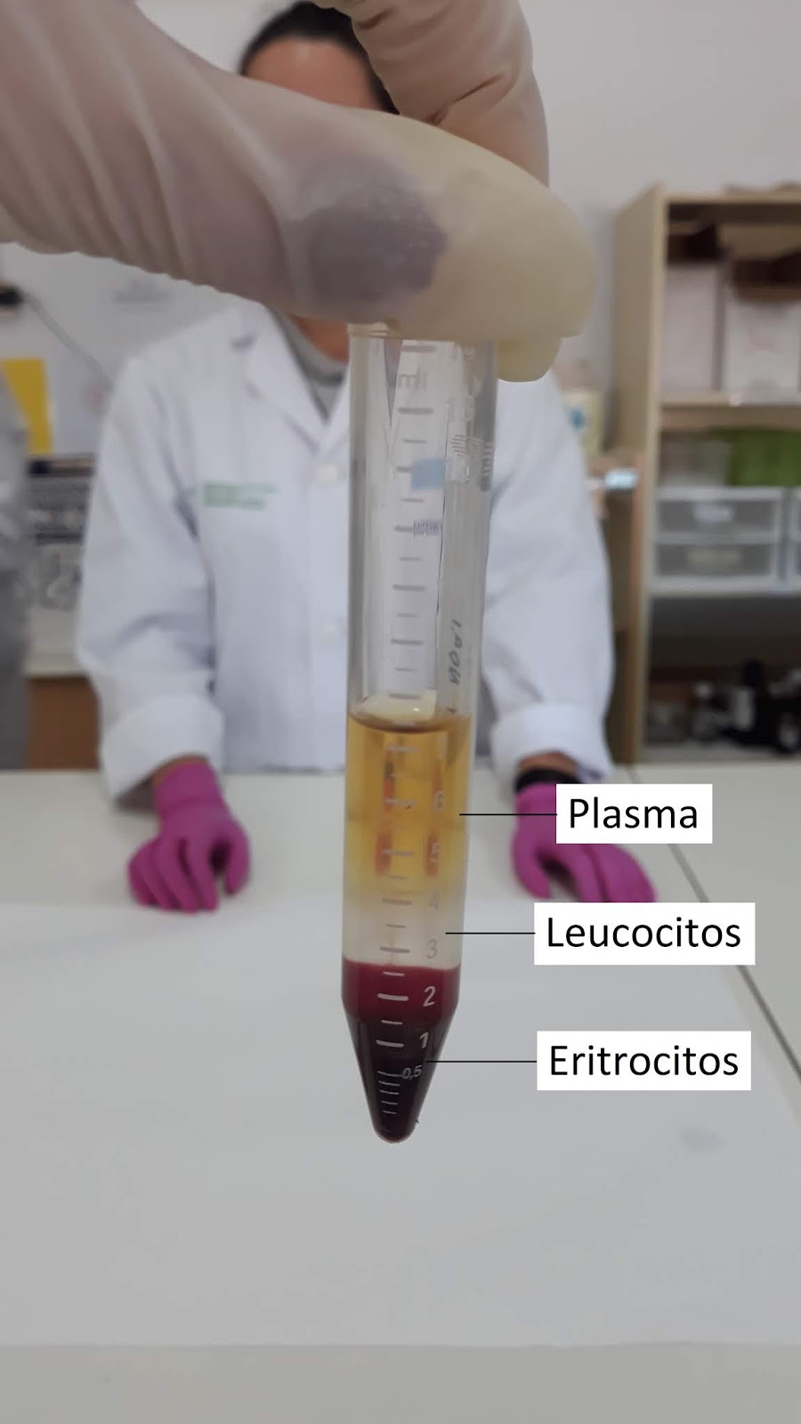 Práctica 12: Técnica de Ficoll