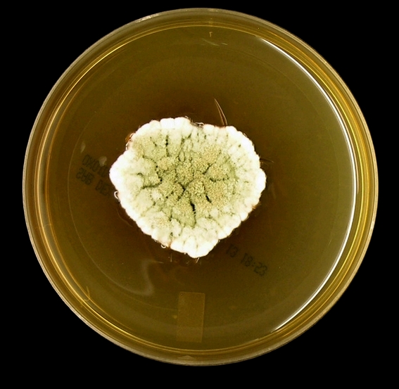 Fun With Microbiology (What's Buggin' You?): Aspergillus versicolor