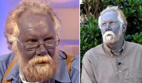 MFS-Strange but TRUE: Paul Karason (The BLUE MAN)