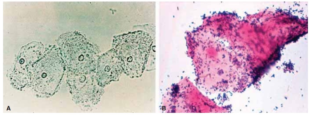 [Microbiology] Atlas of Miscellaneous Body Fluids | Free Medical Atlas