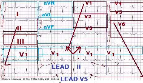 MAS PHARMACY REVIEW-HEALTH TIMES: SUMMARY-ECG EDUCATION-F-SAMPLE ECGS ...
