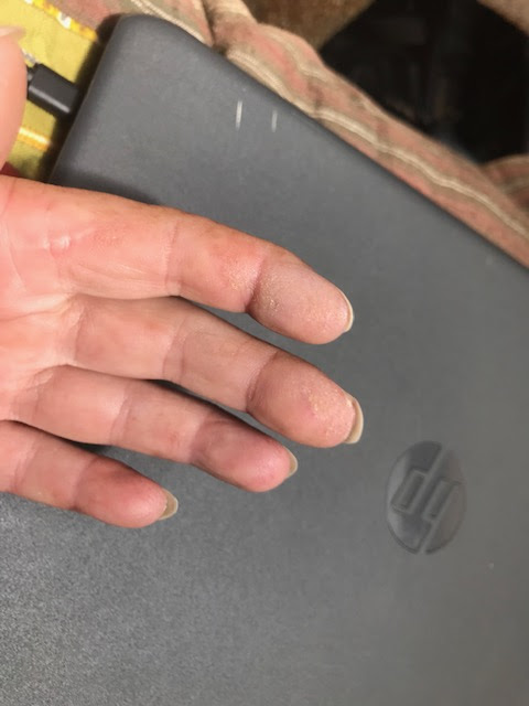 The Hand-Hell Blog - If Your Hands Hurt, Welcome Home!: 2021