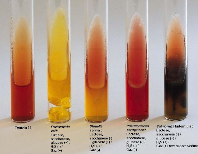 14. IDENTIFICAÇÃO DE ENTEROBACTÉRIAS