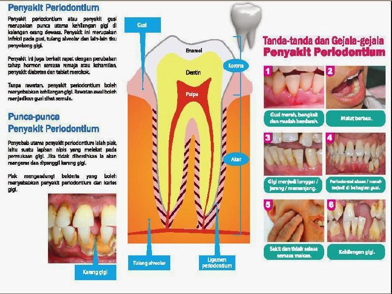 Blog Rasmi Bahagian Kesihatan Pergigian Negeri Perlis: September 2014