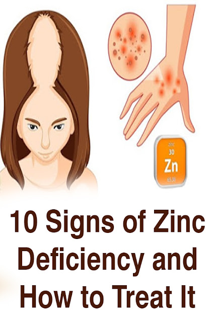 10 Signs of Zinc Deficiency and How to Treat It - frestriobedrle