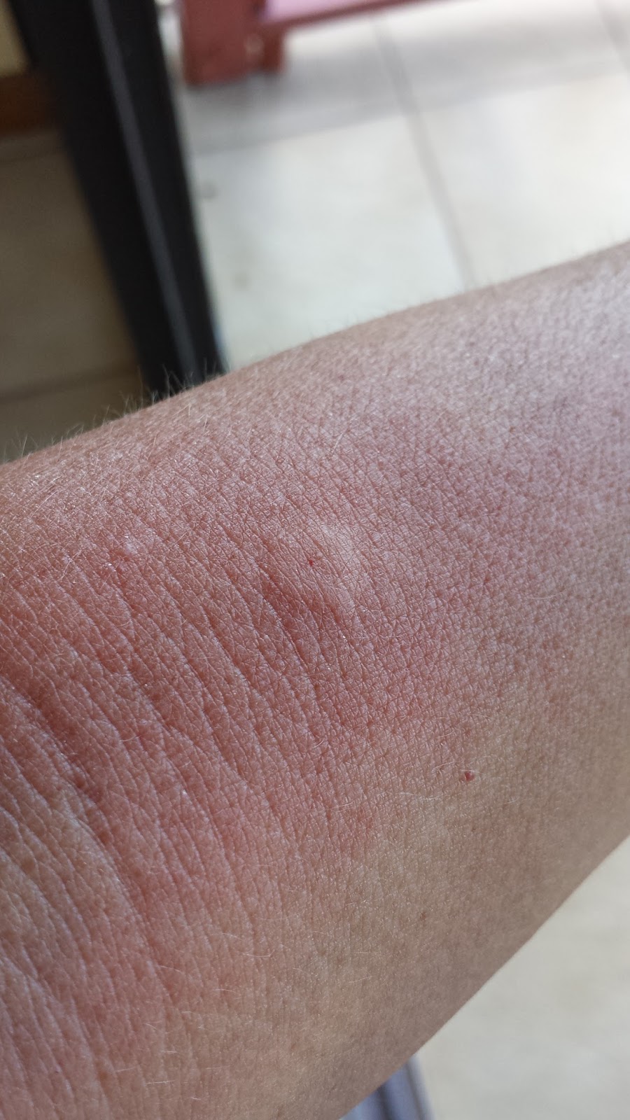 Articles That Teach Us How To Heal Ourselves: Apis for Healing Bites ...