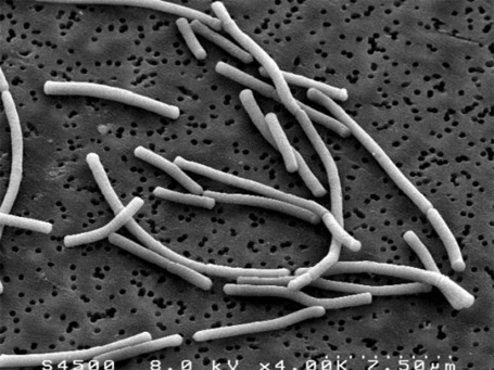 Introdução ao microorganismo - Lactobacillus bulgaricus