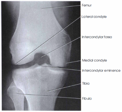 AP WEIGHT-BEARING BILATERAL KNEE PROJECTION: KNEE | Radiology Basics ...